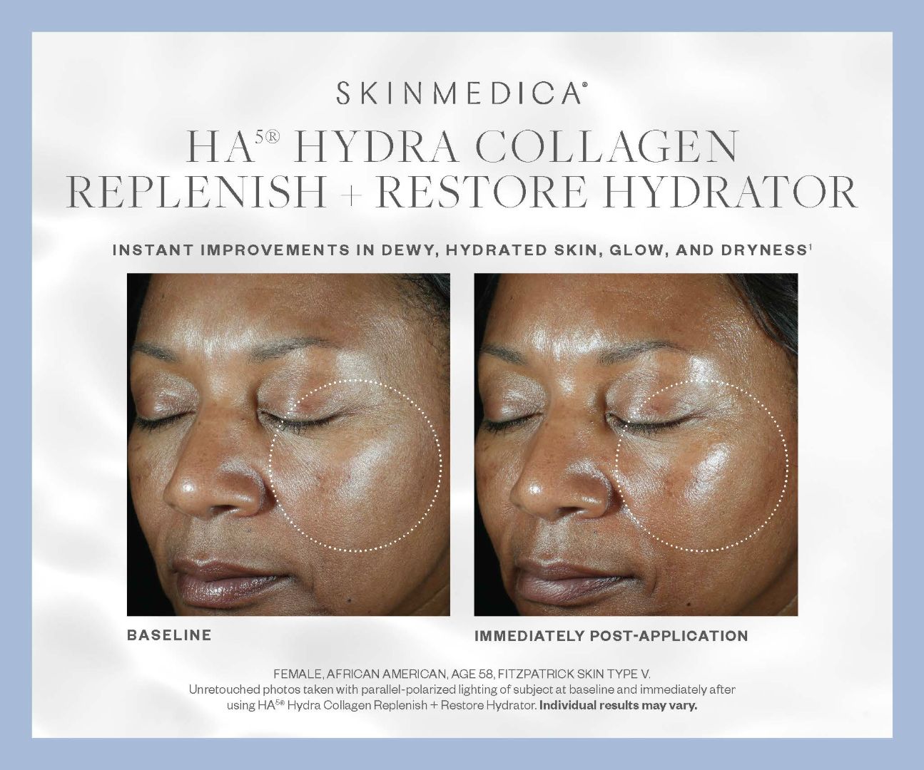 SkinMedica SkinMedica HA5+Hydra Collagen Replenish+Restore Hydrator ...